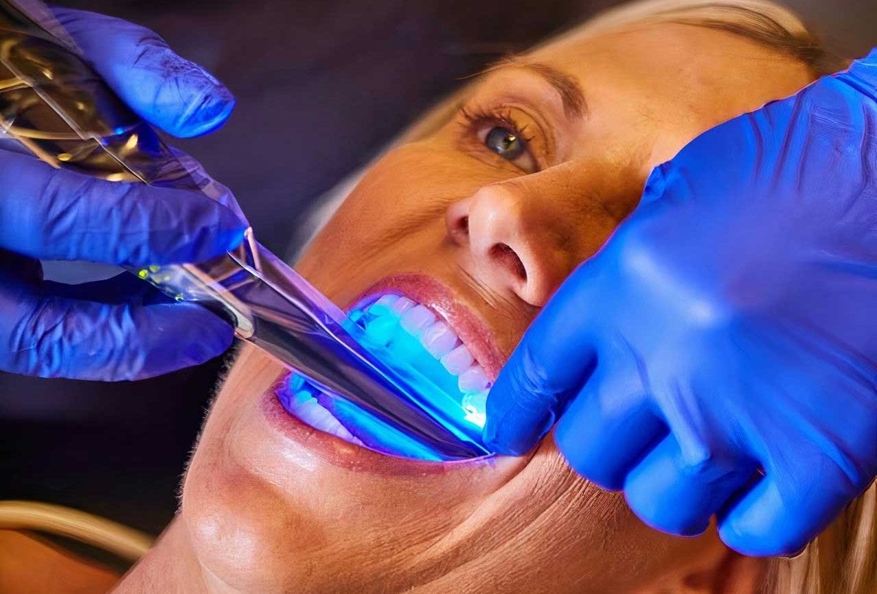 Laser Cavity Detection in Costa Rica at America Dental Clinic